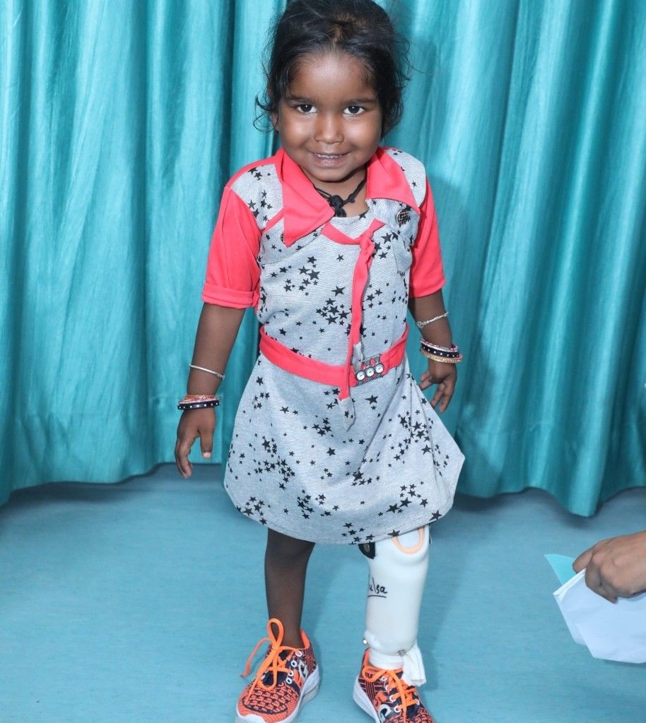 Best Artificial Limbs Cost in India - Artificial Prosthetic Leg Centre ...